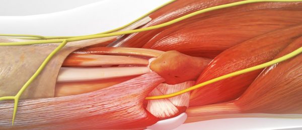 An overview about types of neurosurgery | Healing Consulting Turkey