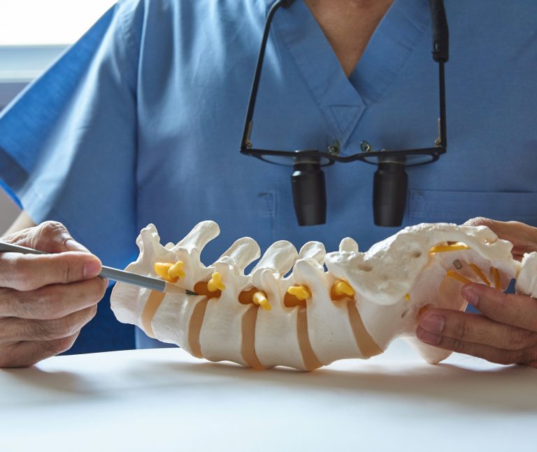 Spine Surgery and All Information about it | Healing Consulting Turkey